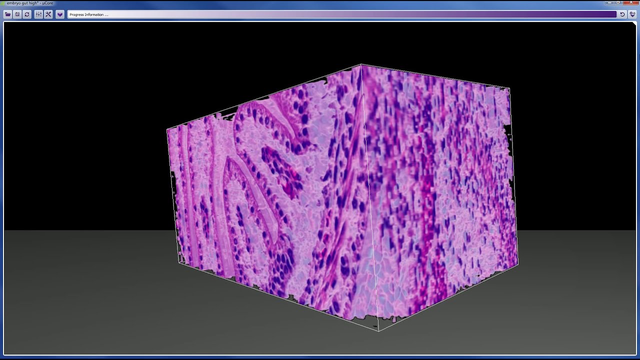 3DHISTECH - Cell nuclei detection in 3DView software - YouTube