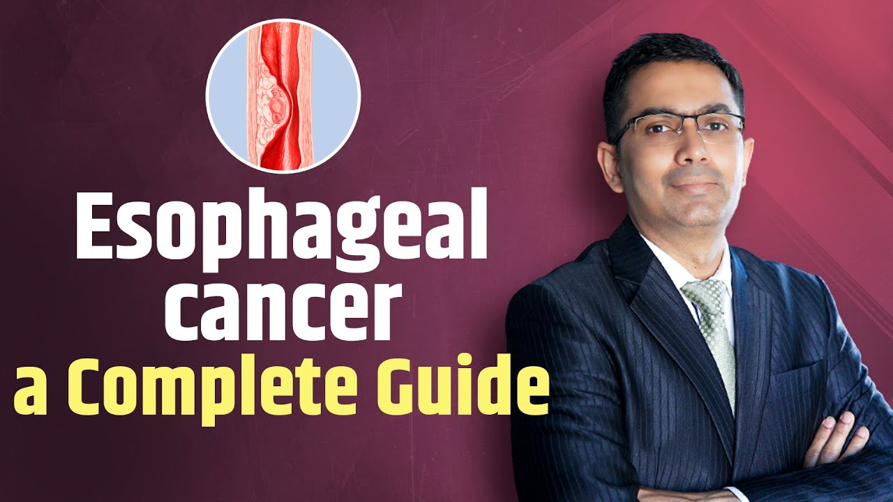 What is esophageal cancer? Know the Causes, symptoms, screening ...