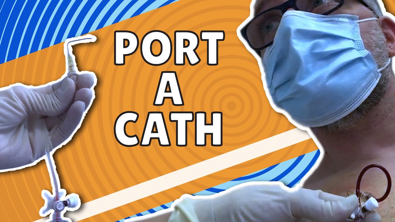 Port A Cath lavaggio prelievo e manutenzione con ago Huber - YouTube