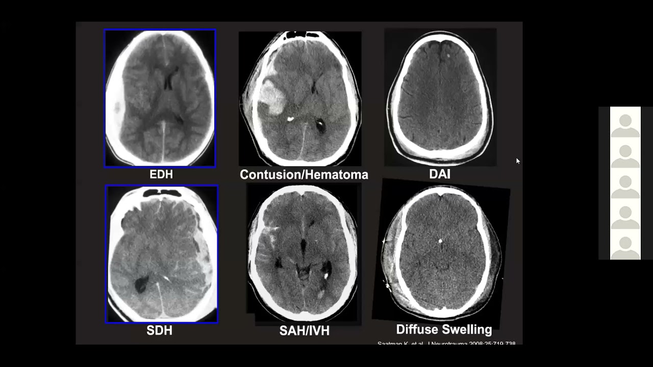 Medical Student Lecture Series: Neurotrauma with Zachary L. Hickman, MD ...