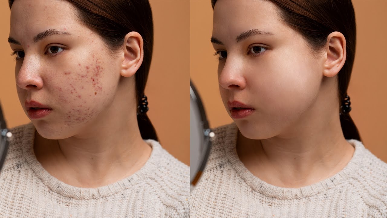 Skin Retouching - Photoshop CC Tutorial | Face Retouching - YouTube