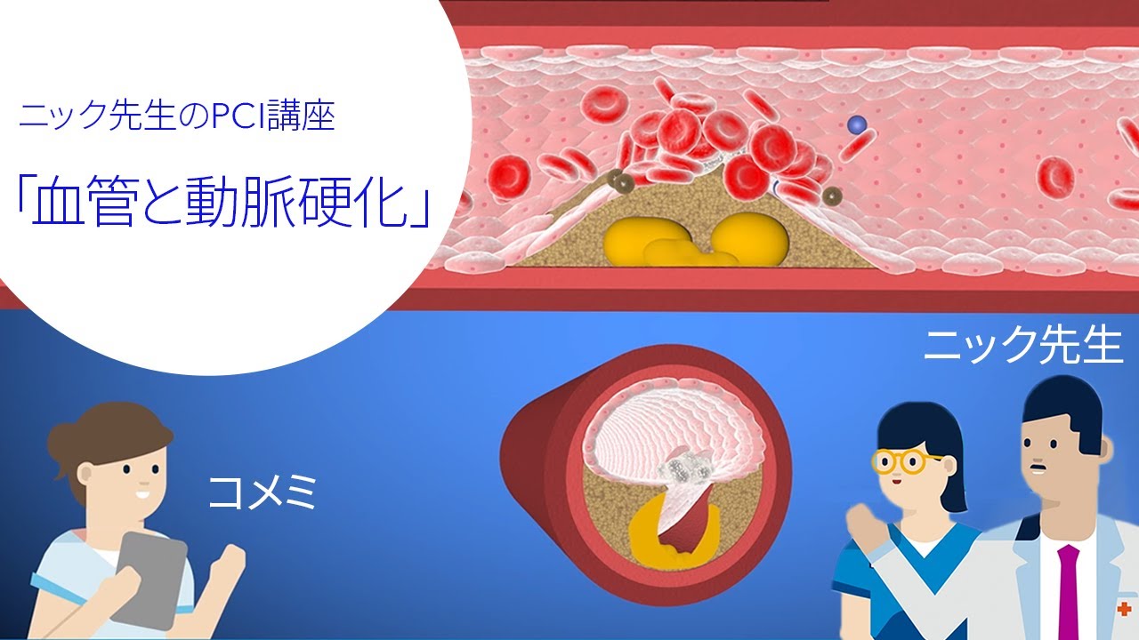 ニック先生のPCI講座 「血管と動脈硬化」編 - YouTube