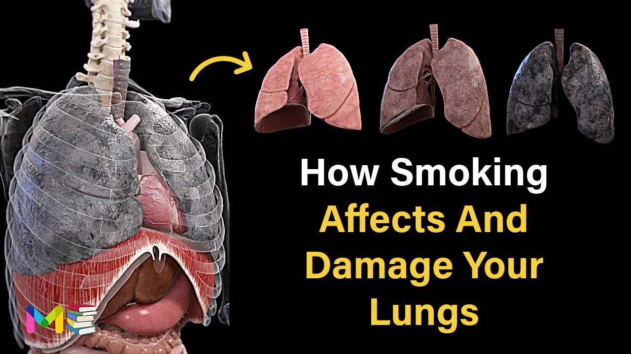 HOW SMOKING AFFECTS AND DAMAGES YOUR LUNGS - YouTube