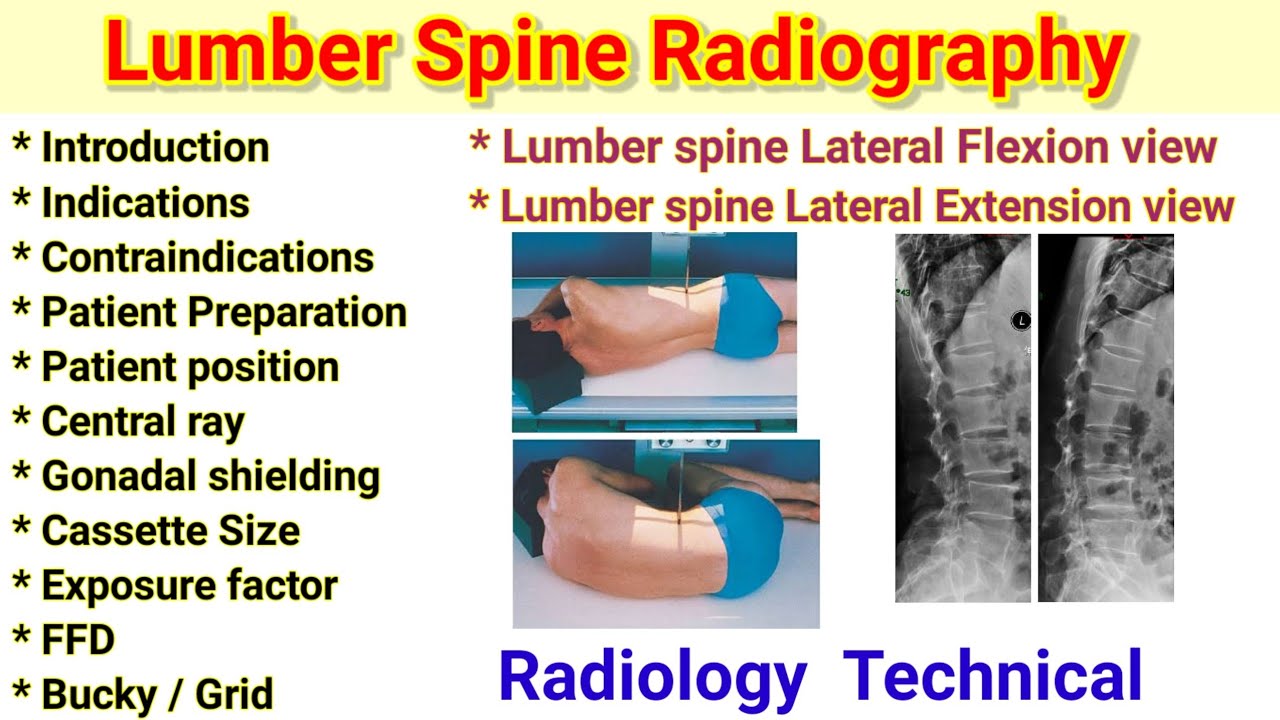 Lumber Spine Radiography # Lateral Flexion view # Extension view # ...