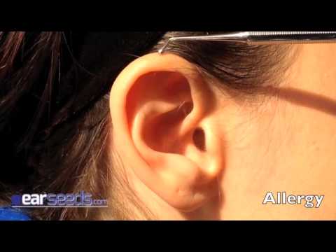 Allergy Auriculotherapy Ear Point - YouTube