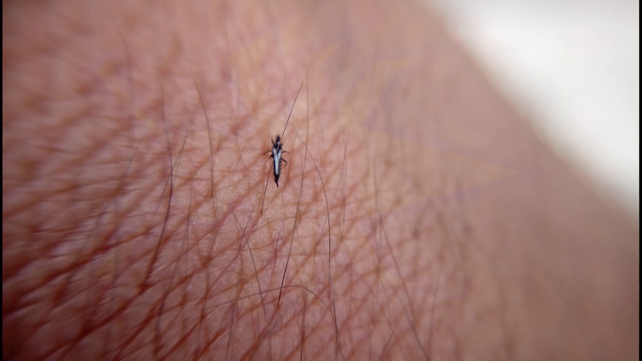 Insectito Negro ¿Sabes Como Se Llama? - YouTube