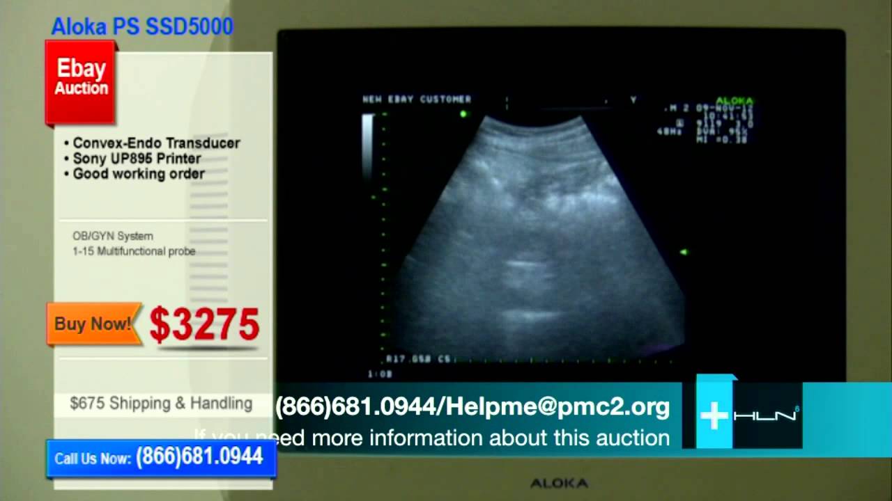 Aloka SSD-5000 OB/GYN Ultrasound System - YouTube