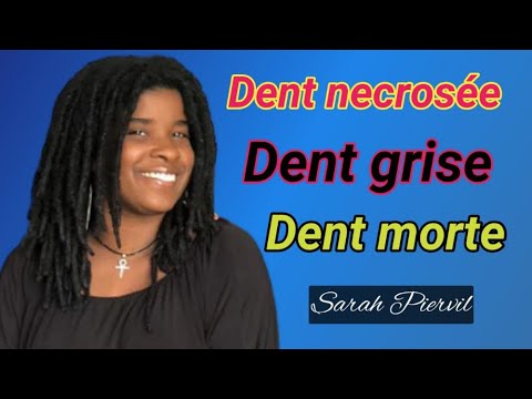 Dent necrosée,dent grise,dent morte - YouTube