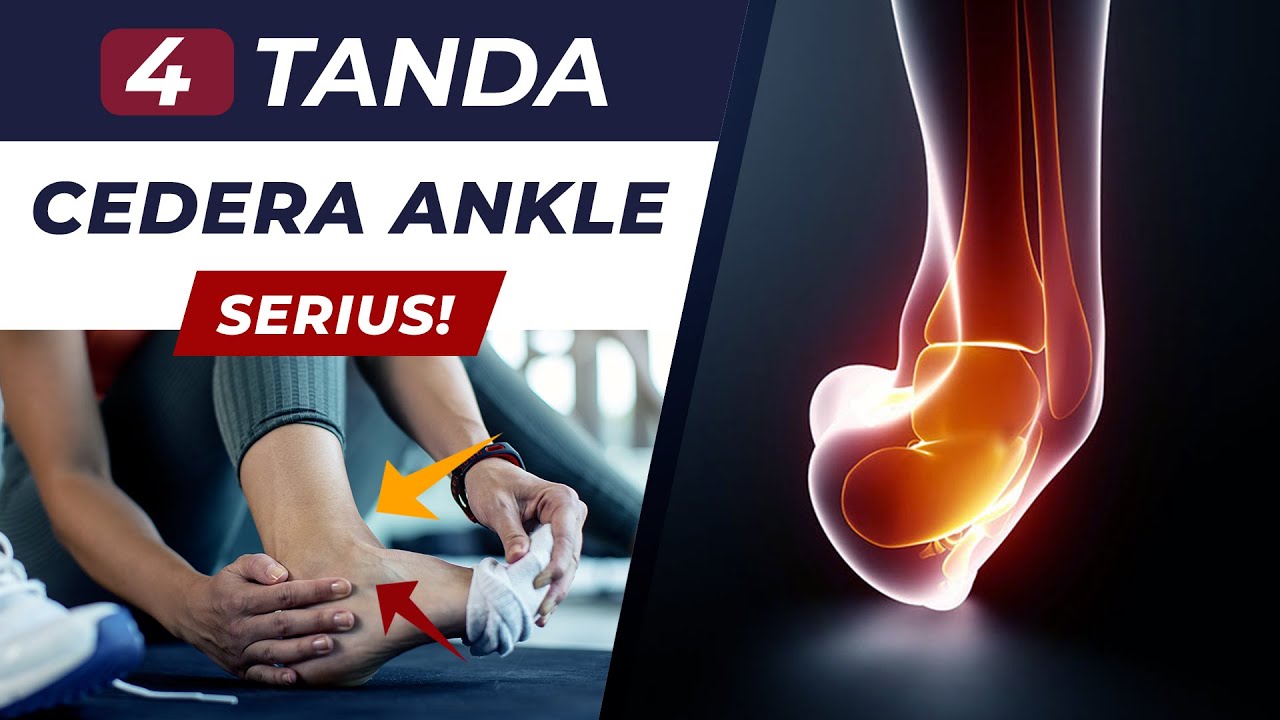 4 Tanda Cedera Ankle Serius - YouTube