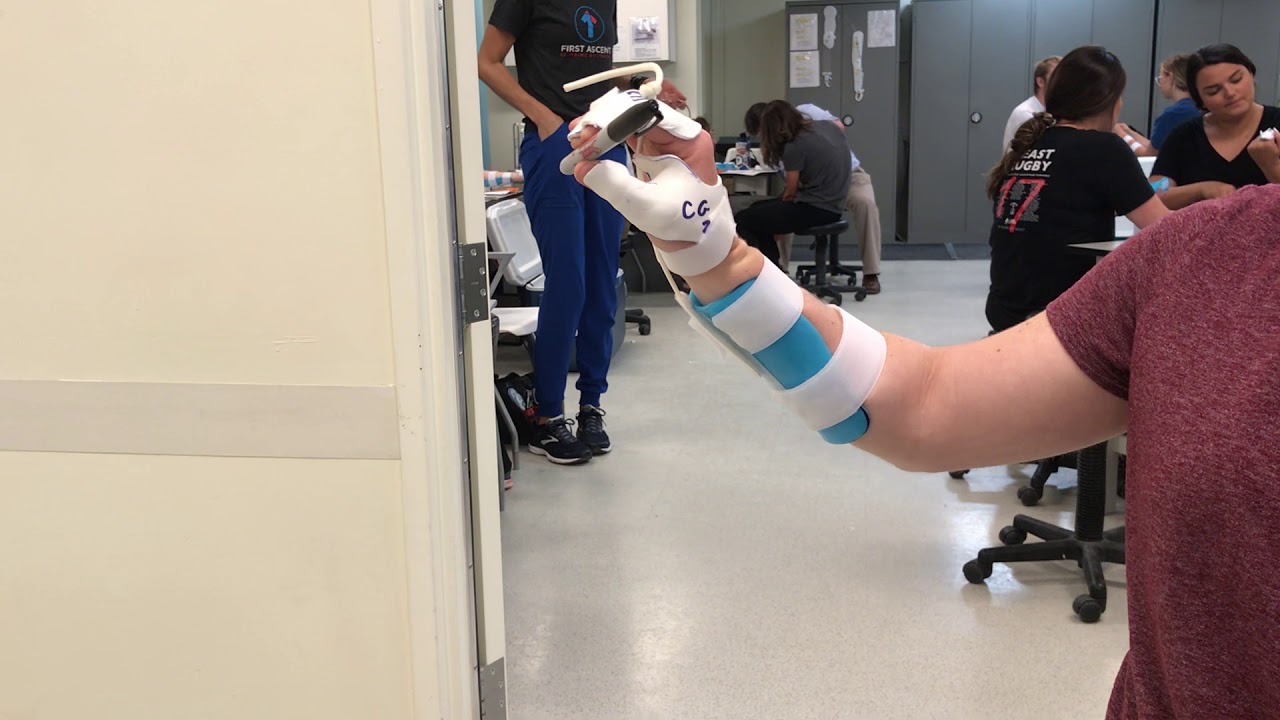 Tenodesis-style WHO I made from low-temp thermoplastic - YouTube