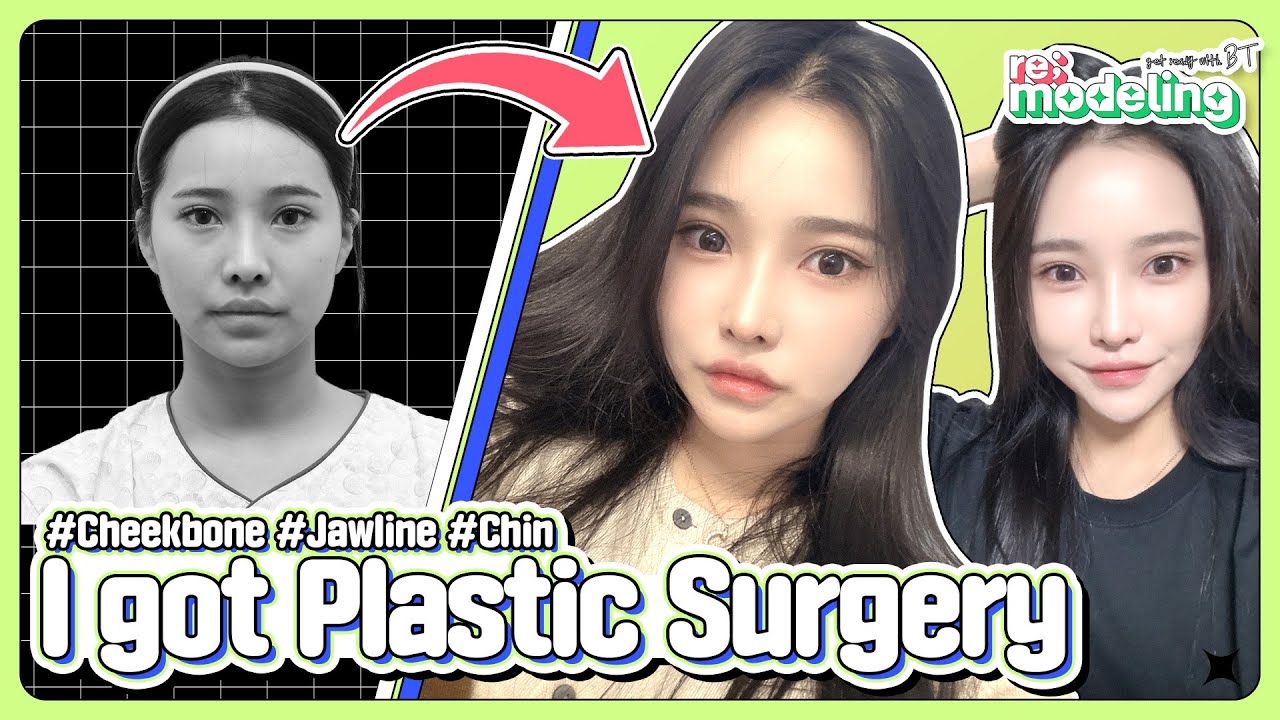 Facial bone contouring surgery in Korea, Cheekbone reduction, Jawline ...