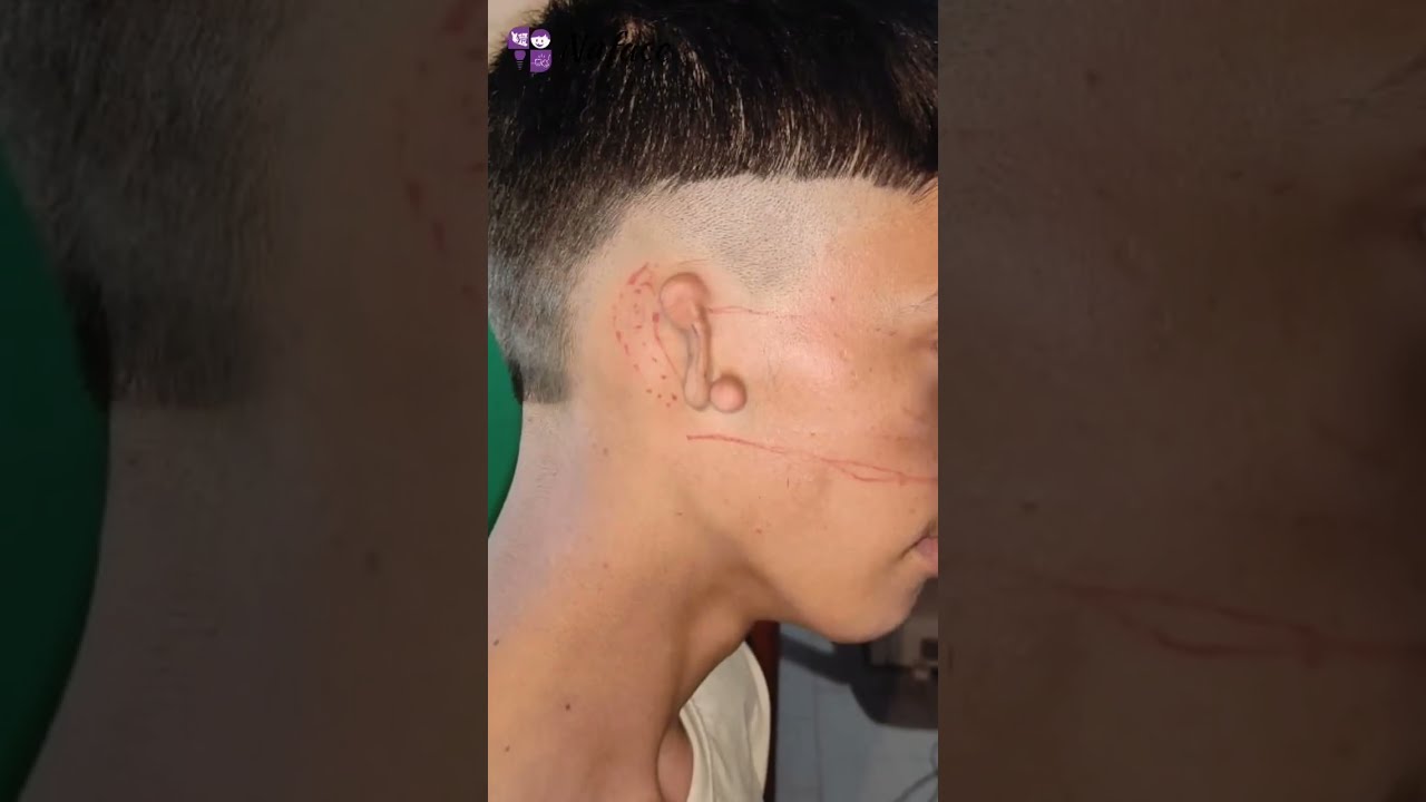 Ear Reconstruction Surgery | Dr Parit Ladani | Nuface - YouTube