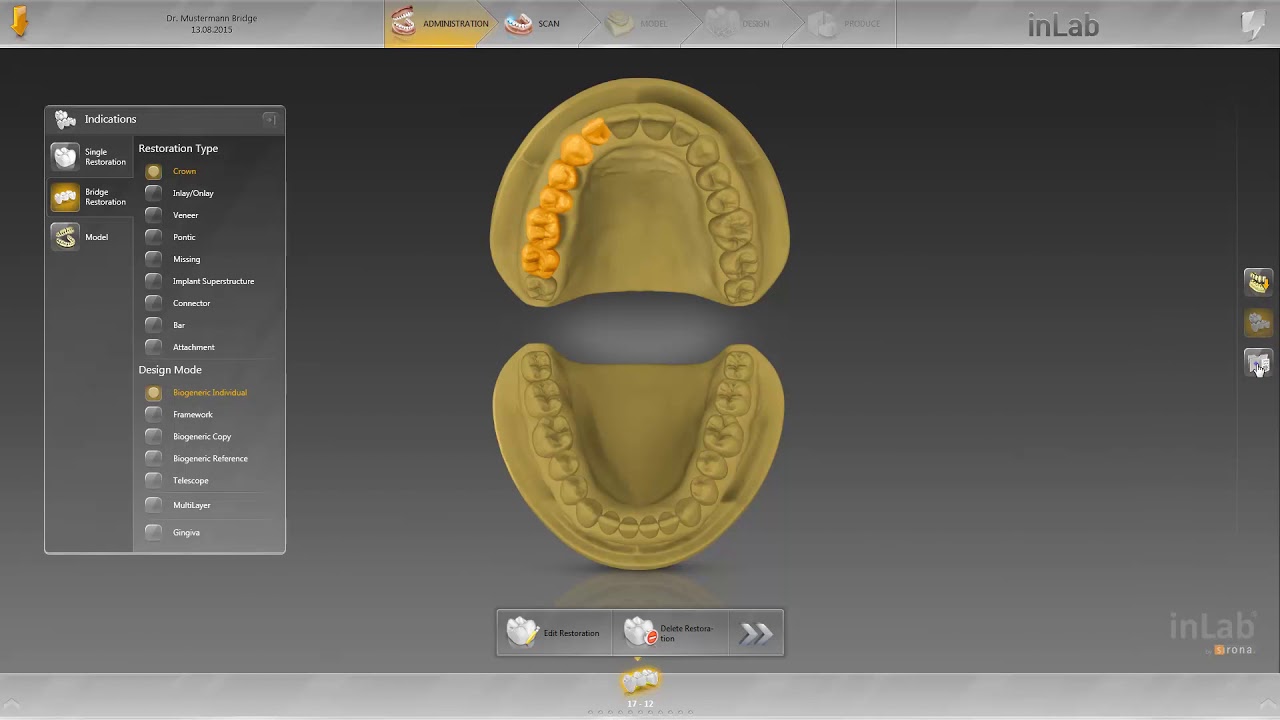 inLab Workflow - YouTube