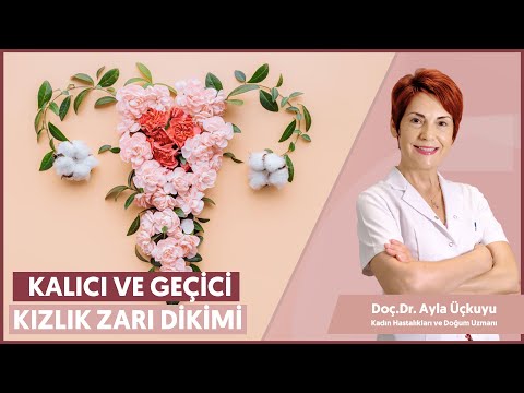 Kalıcı ve Geçici Kızlık Zarı Dikimi