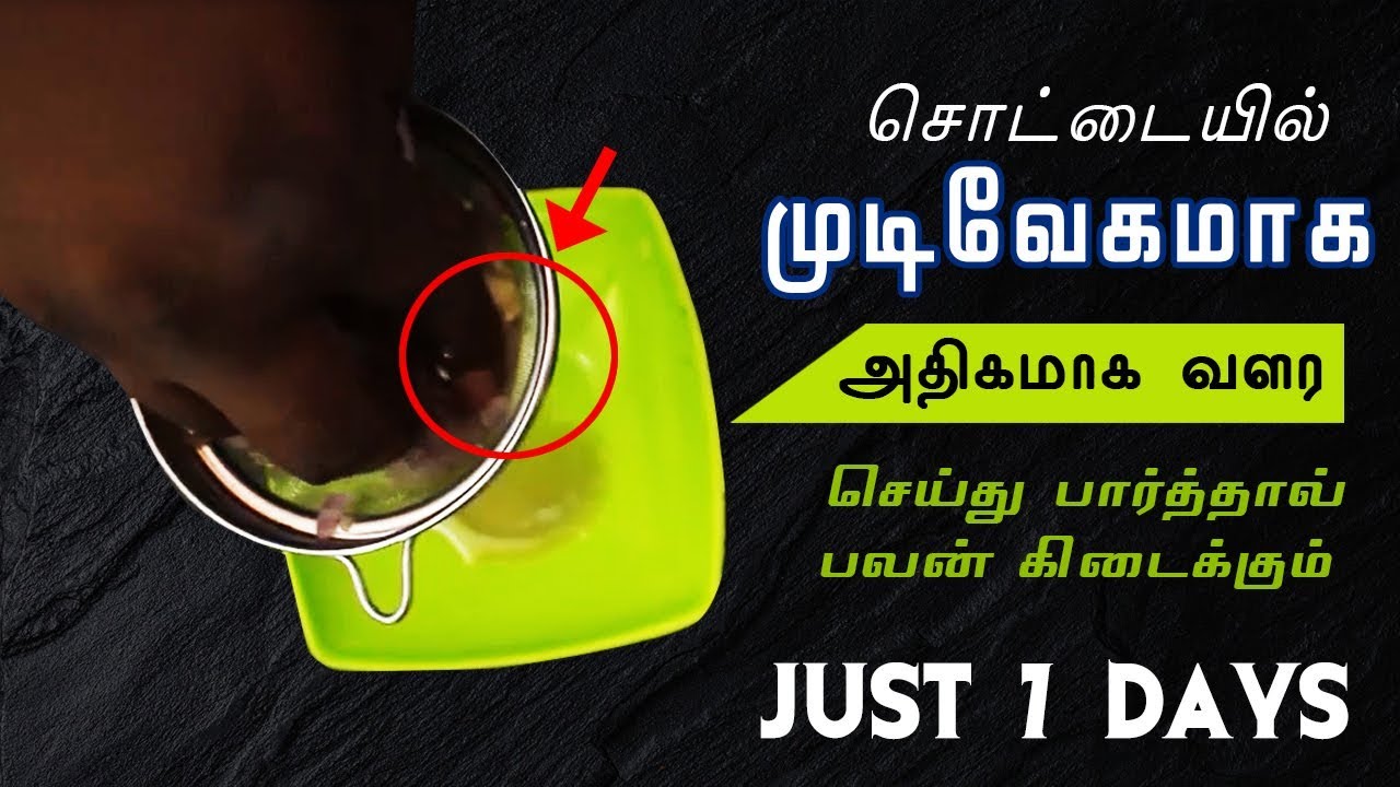 முடி சொட்டையில் அதிகமாக நீளமாக வளர Hair Growth Tips Youtube