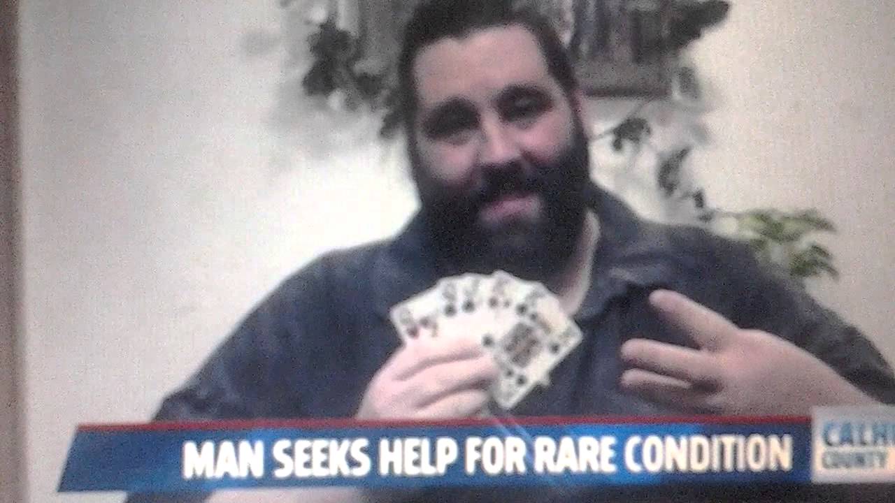 Fox 17 1st news video Dan Maurer Scrotal Lymphedema - YouTube