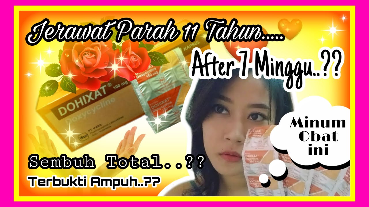 ANTIBIOTIK UNTUK JERAWAT (DOHIXAT DOXYCYCLINE 100 Mg) - Review Jujur ...