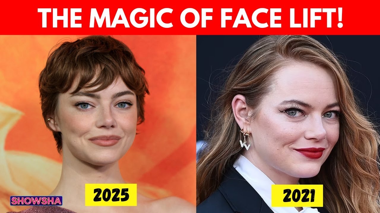 Emma Stone’s 'New Face' Sparks Buzz After Kris Jenner & Anne Hathaway’s ...