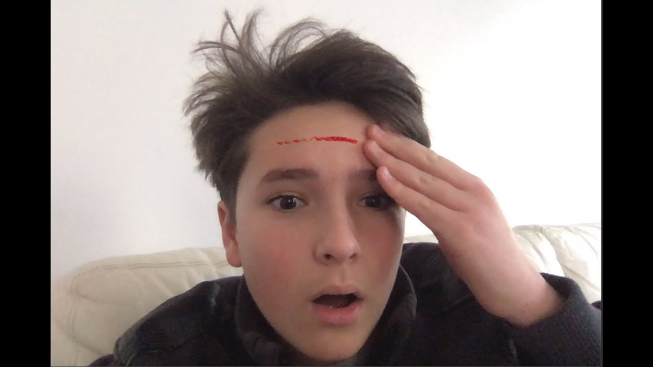 Hitting my head using my computer (serious injury) (had to go to ...