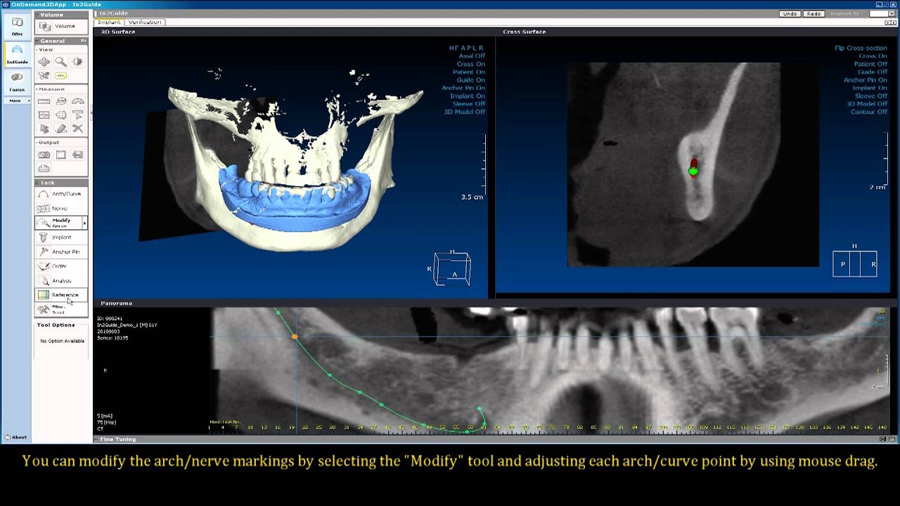 In2Guide Module - YouTube