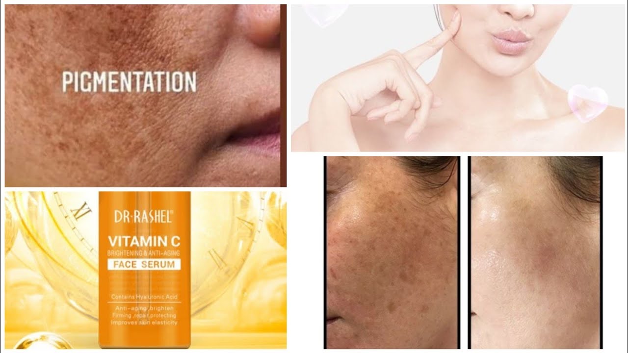 skin ki chahiya daagh dhaby khatam krny ka wahad hall #skincare #like # ...