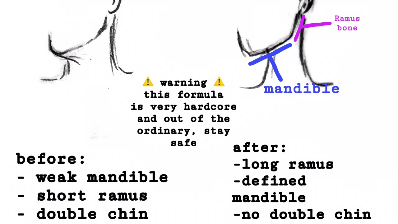 Fix weak jawline - YouTube