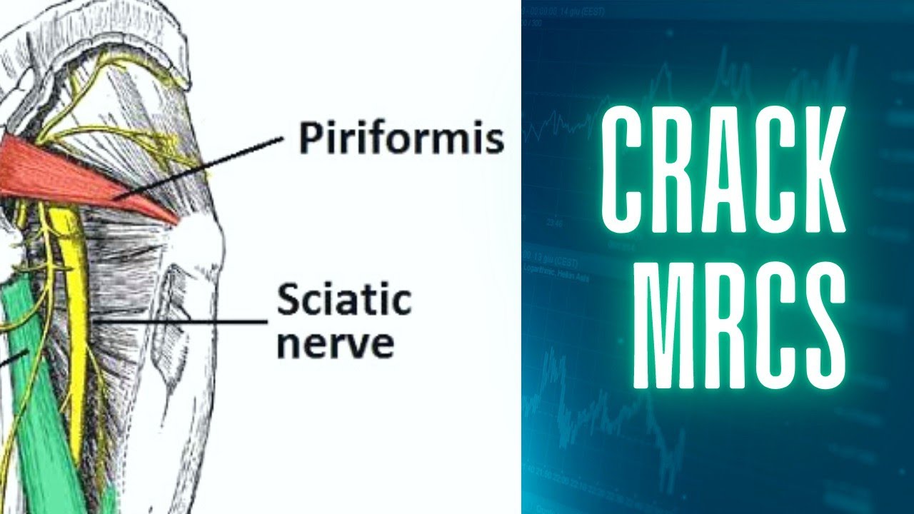 Sciatic nerve at gluteal region MRCS question solve - YouTube