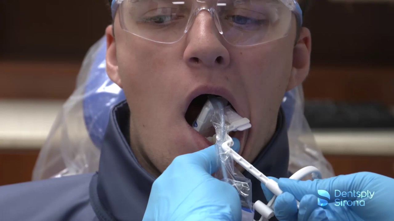 RINN Uni-Grip 360 Anterior Placement | Dentsply Sirona - YouTube