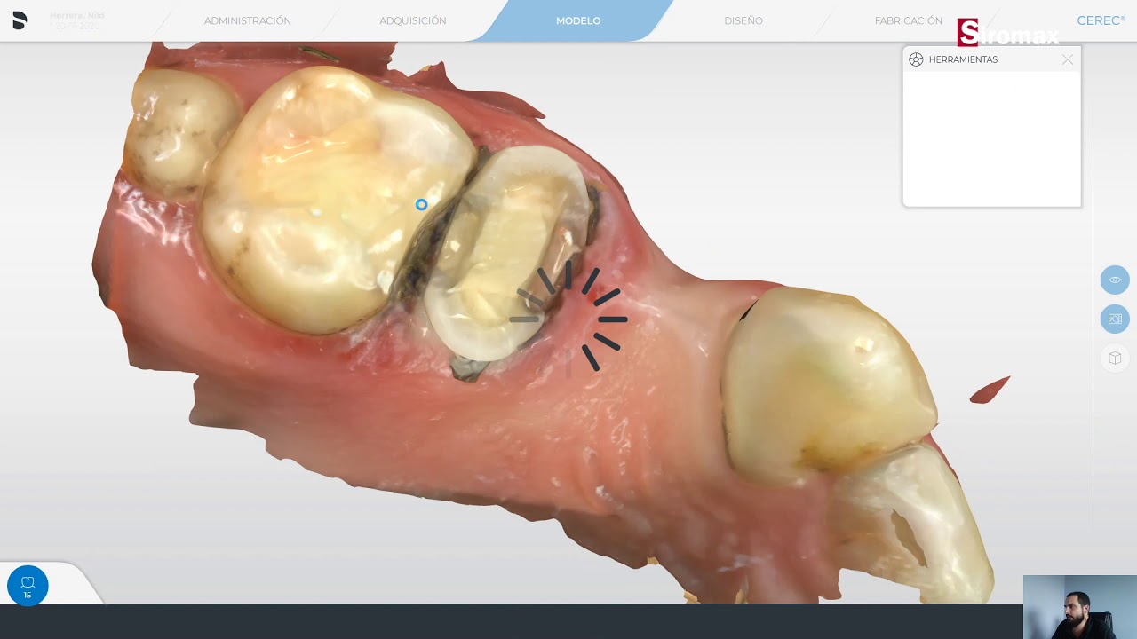 CEREC SW 5.1 Caracteristicas - YouTube