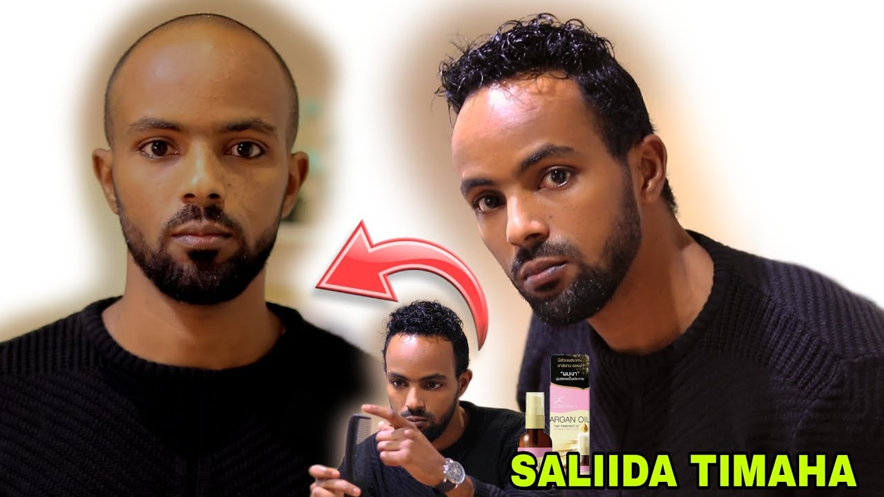 SALIIDA JOOJINEYSO DAADASHADA TINTA iyo BIDARTA SIDA LOOGU HORTAGO ...
