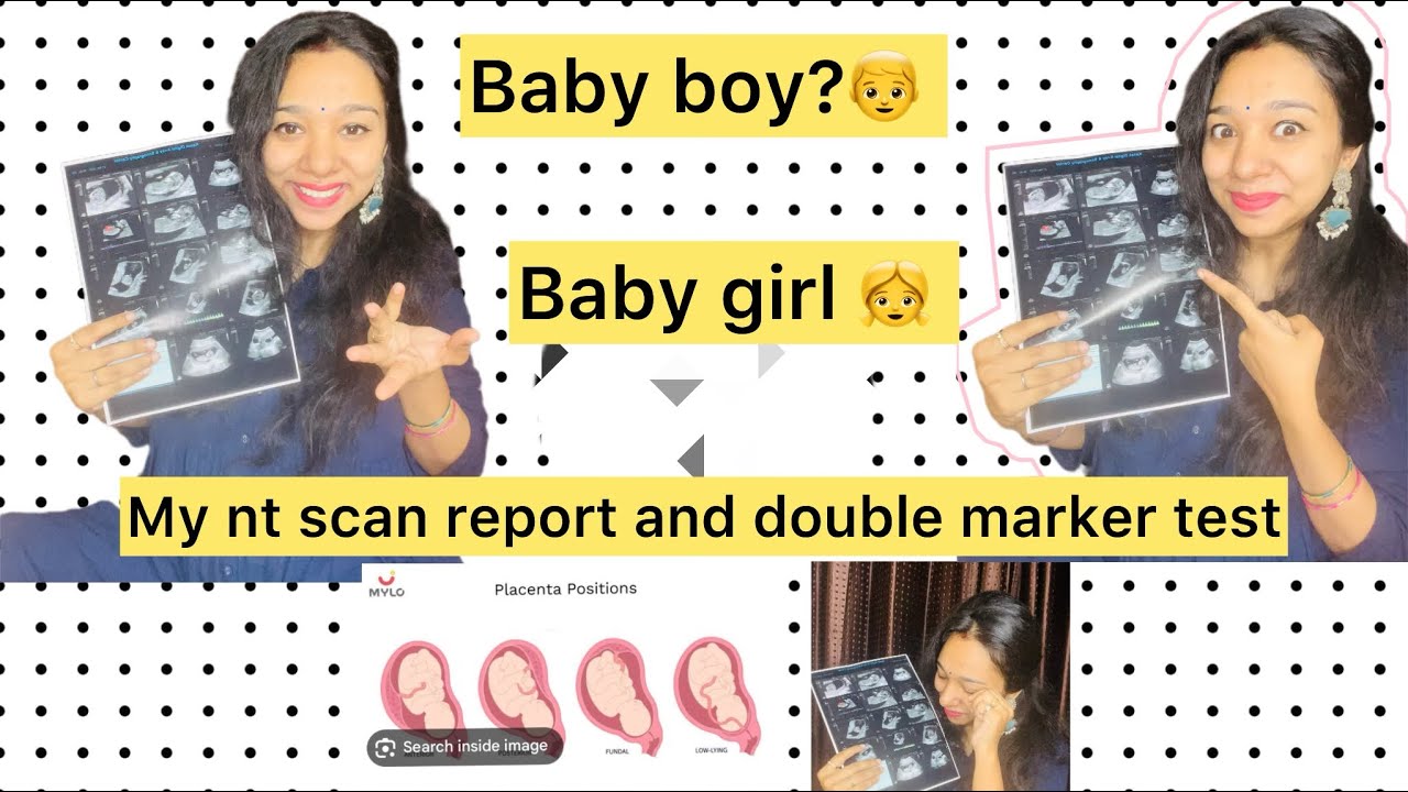 My NT SCAN report and double marker test ?my scan report is normal so y ...