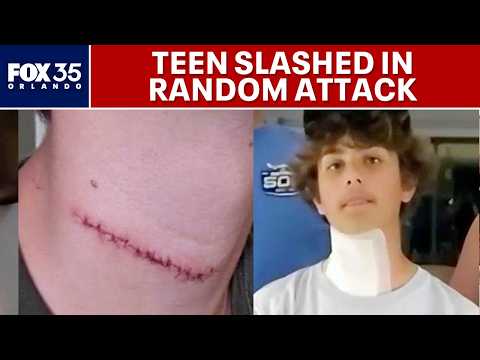 Teen’s throat slashed in random attack near Daytona Beach Pier