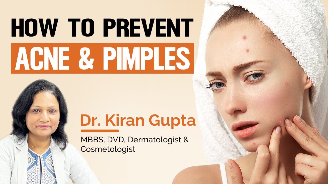 Natural Ways to Prevent Acne and Pimples | Dr. Kiran Gupta - YouTube