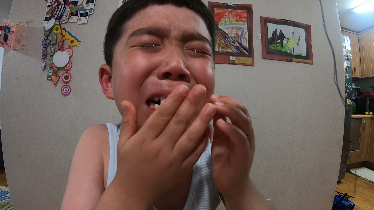 7 year old boy 2nd tooth extraction (self pulling tooth out at home ...