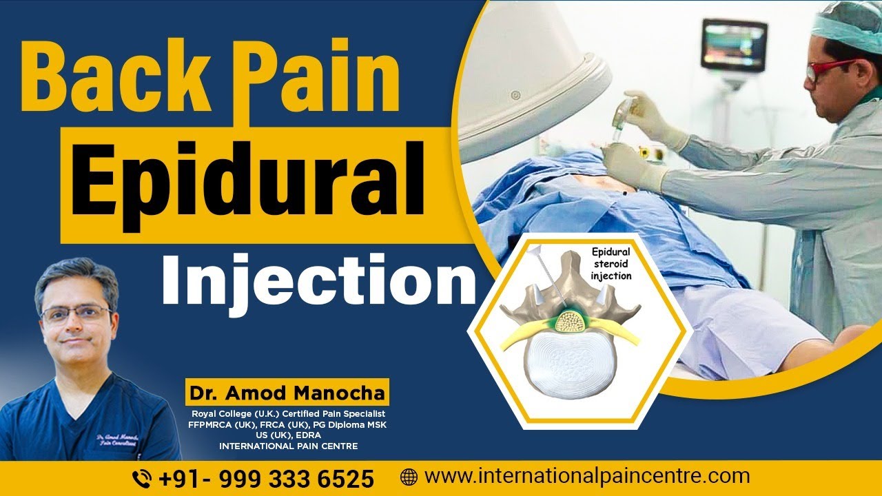 Epidural Injection & Nerve Root Block for Sciatica Pain Management | Dr ...