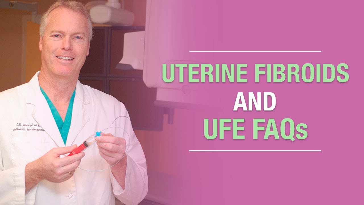 Uterine Fibroids and UFE FAQs - YouTube