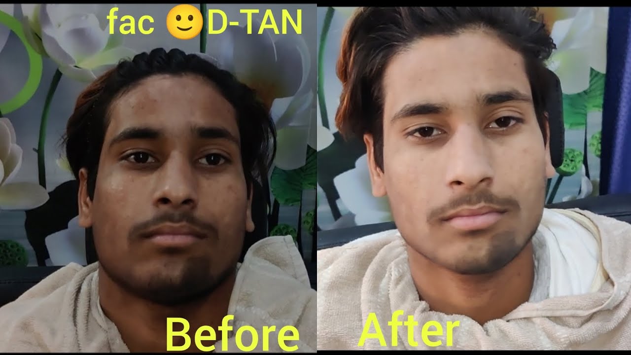 How to do face and neck D-TAN 💯 setb by step👍,,face nad neck bleach ...
