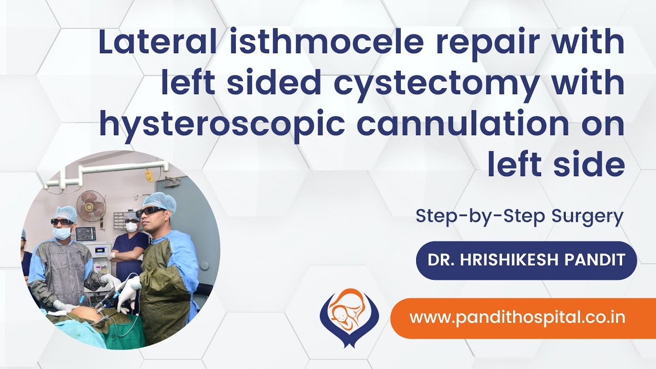 Lateral isthmocele repair with left sided cystectomy with hysteroscopic ...