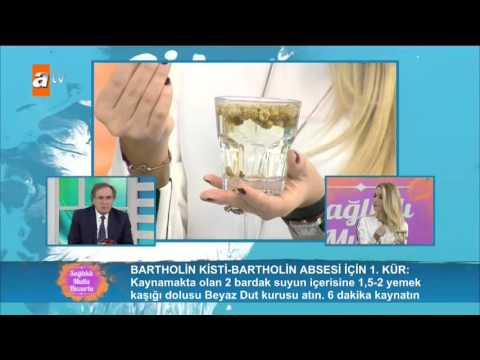 Bartholin kisti ve absesi için kür - Sağlıklı Mutlu Huzurlu 60. Bölüm - atv