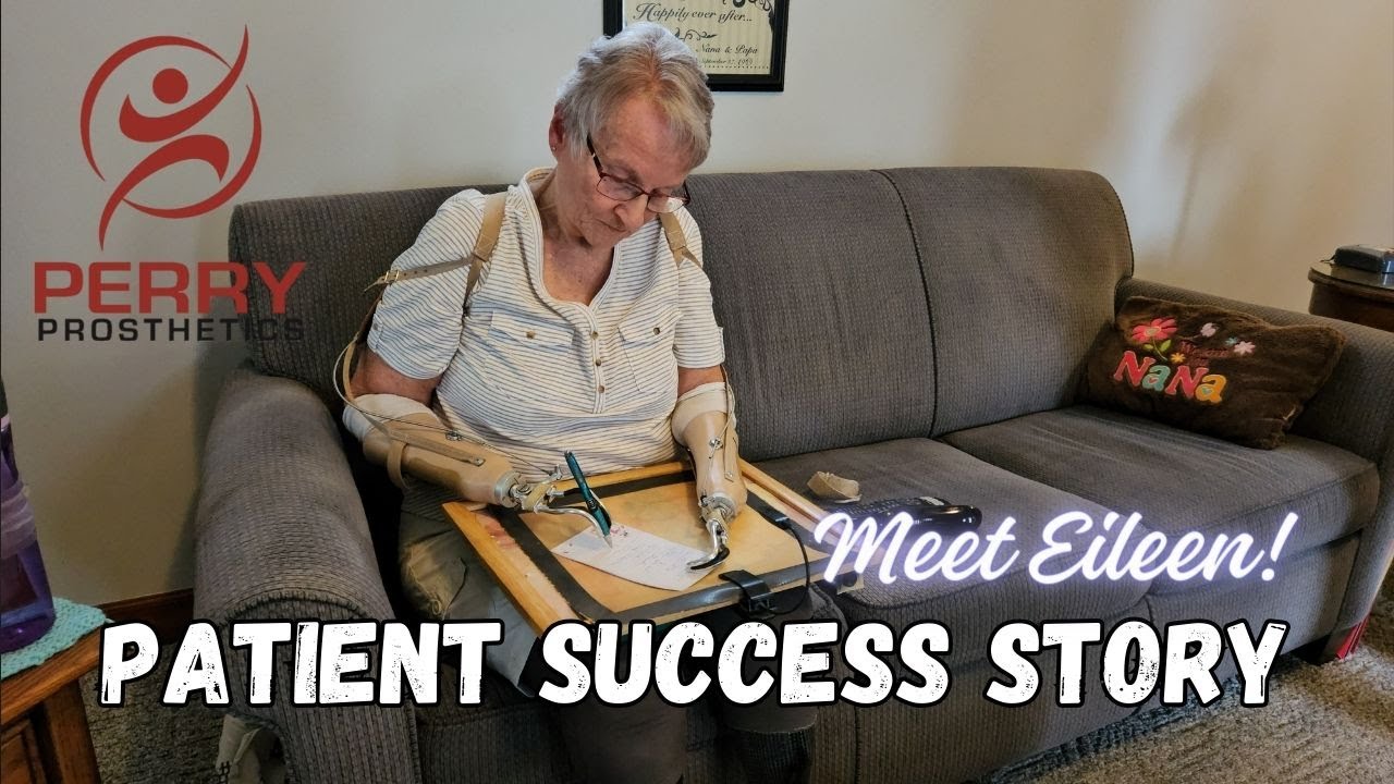 Amputee Success Story: Eileen Ueberroth - YouTube