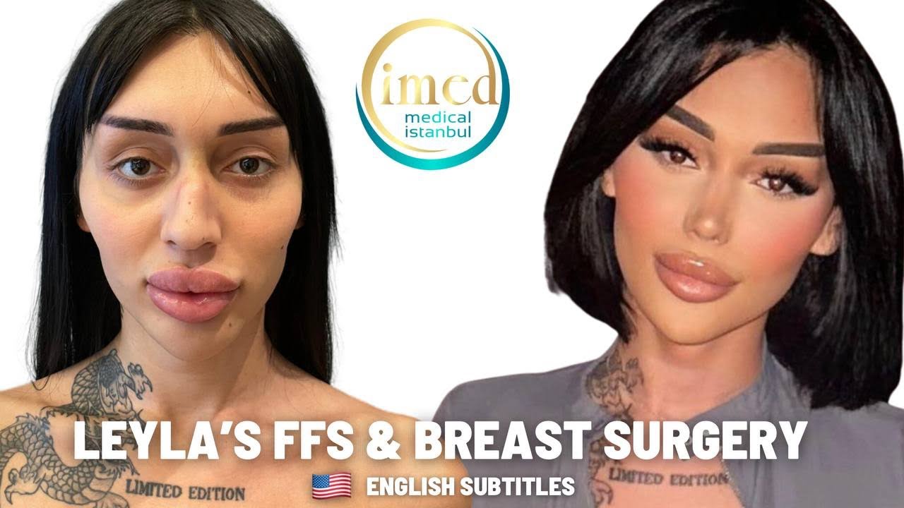 iMed Medical Videos - iMed Medical