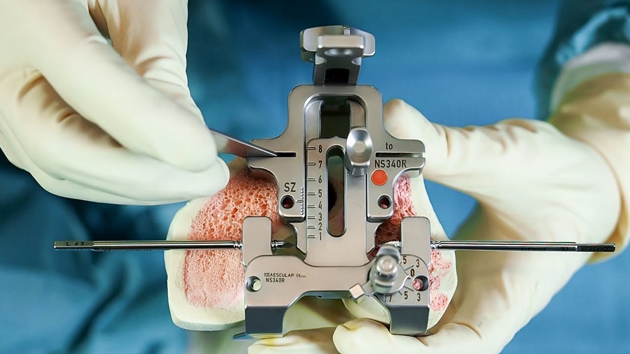 Surgical Technique Manual Procedure AESCULAP® IQ Columbus® - OR Video ...