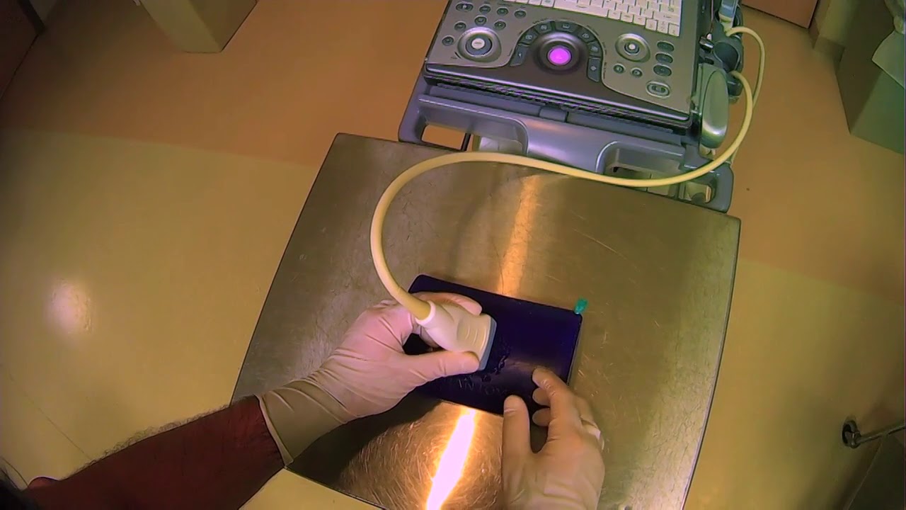 12 Extra Considerations For Tracking Your Needle - YouTube