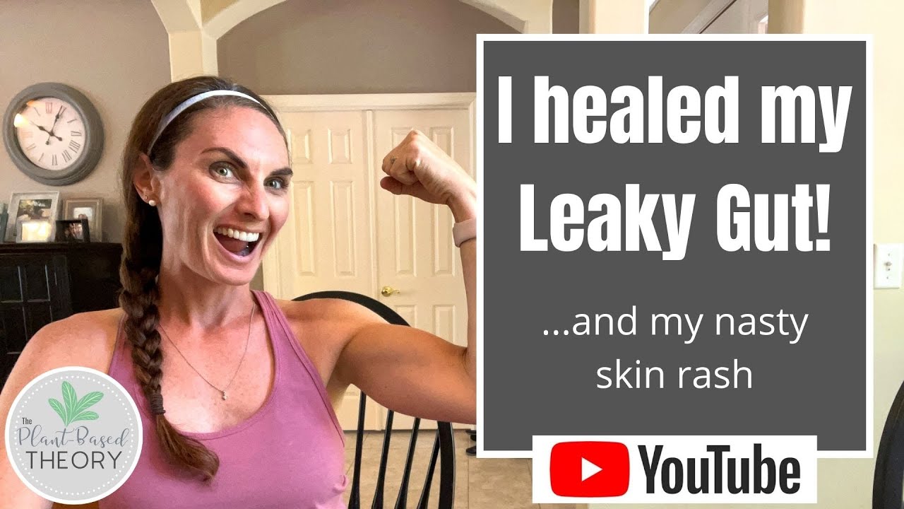 I Healed My Leaky Gut! ...and my nasty skin rash - YouTube