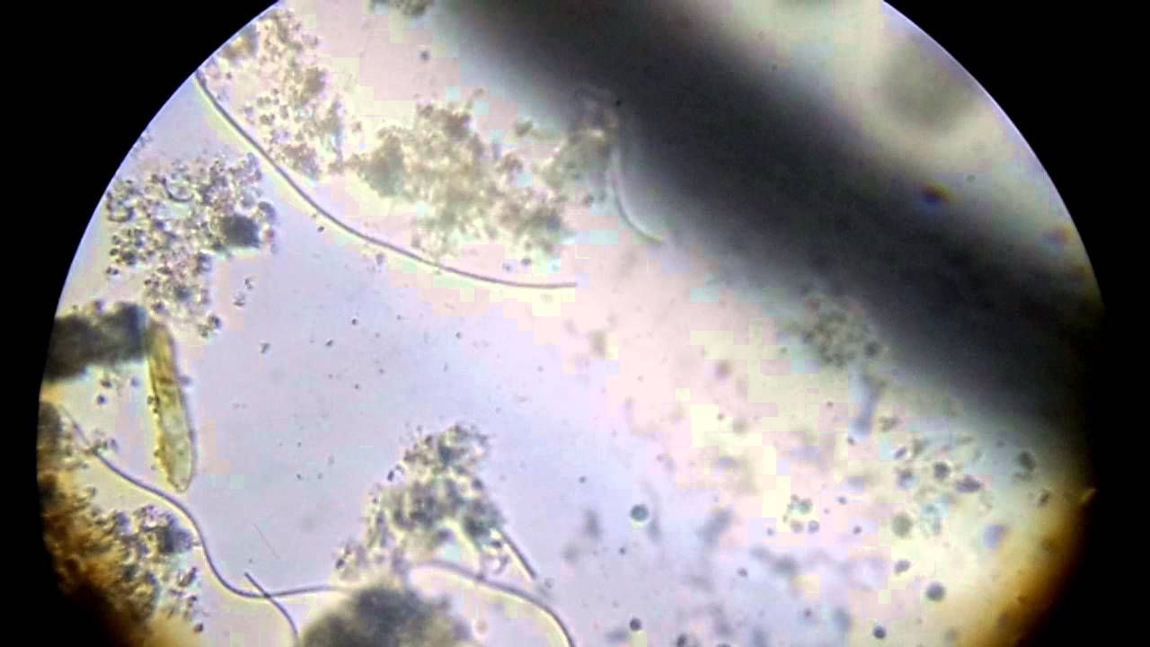 Vida microscopica - YouTube
