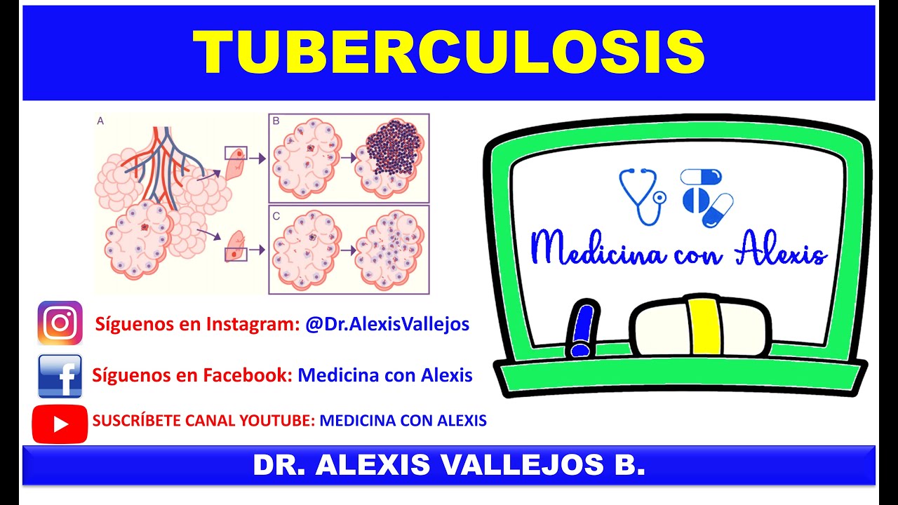 TUBERCULOSIS I : ASPECTOS GENERALES - YouTube