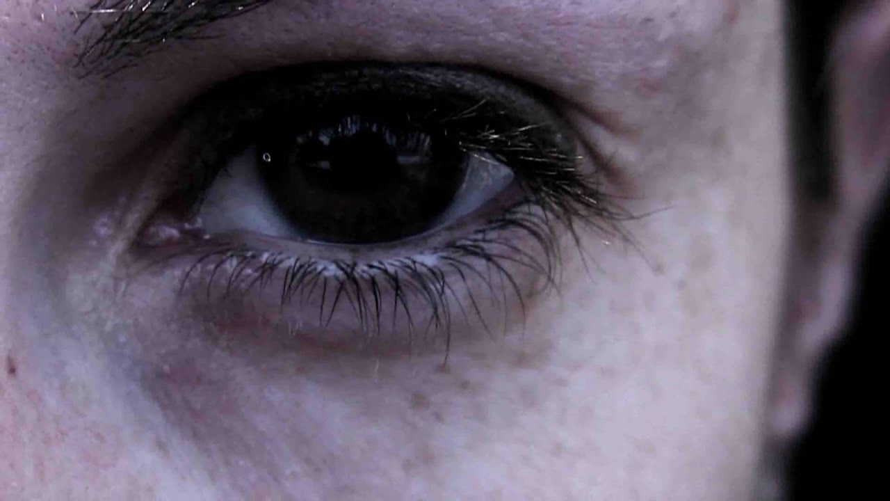 Achromatopsia. A life without colours - YouTube