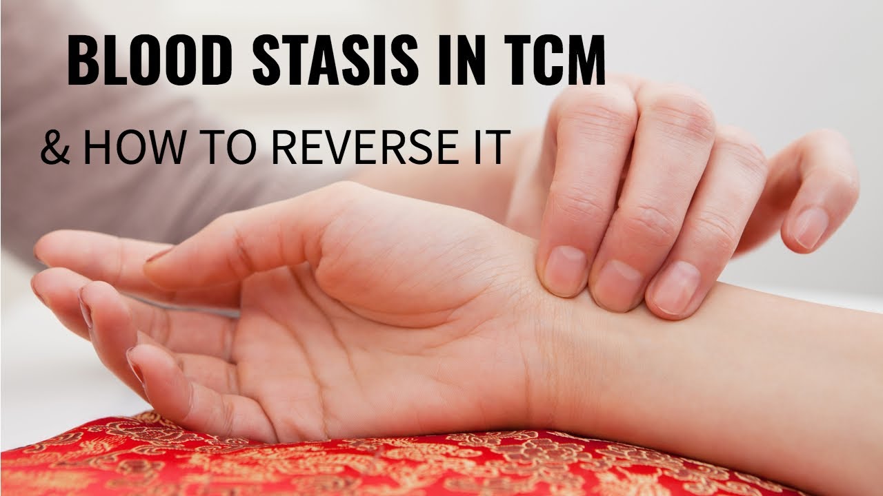Blood Stasis in TCM and How To Reverse It - YouTube
