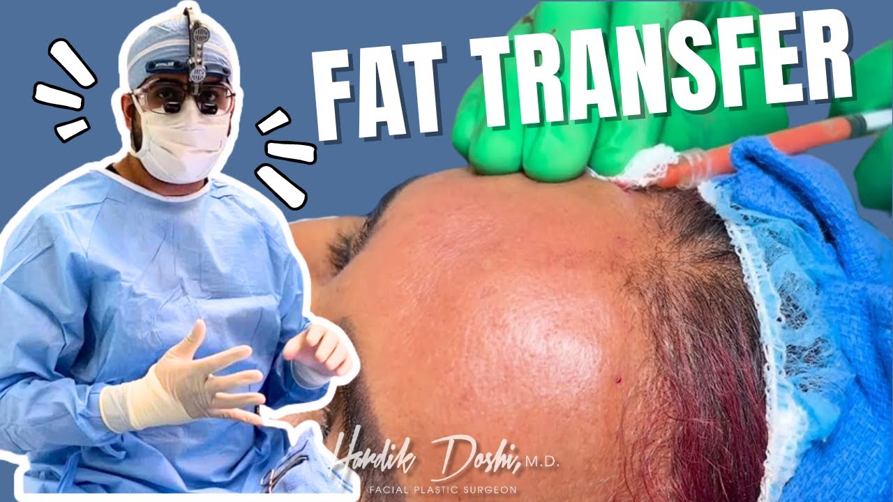 The Ultimate Guide to Fat Transfer: Must Watch - YouTube