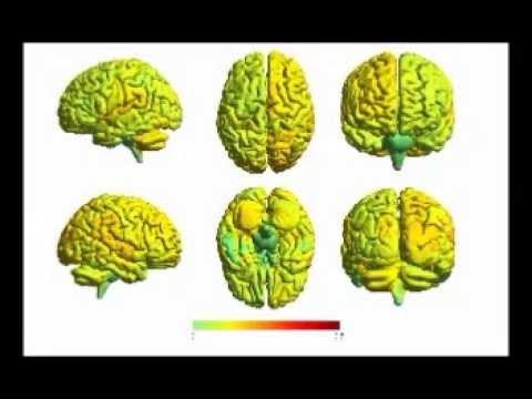 PNAS : Time-resolved resting-state brain networks - YouTube